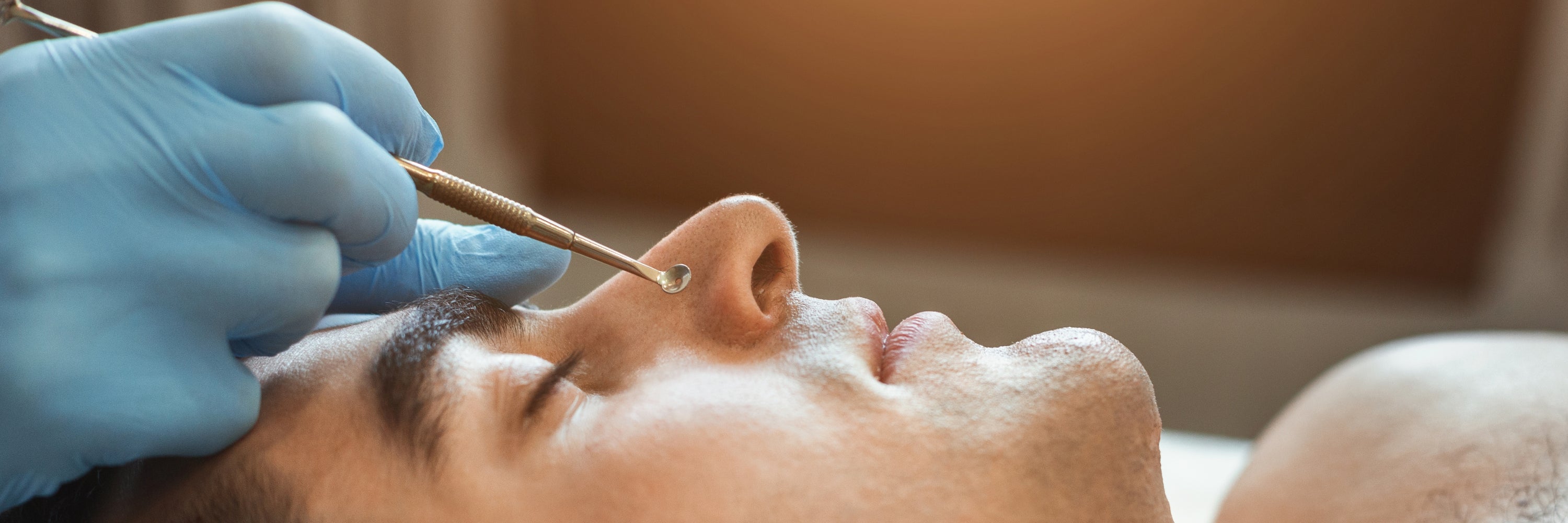 Black Heads On Your Nose - Causes And Solutions For Men – VITAMAN USA